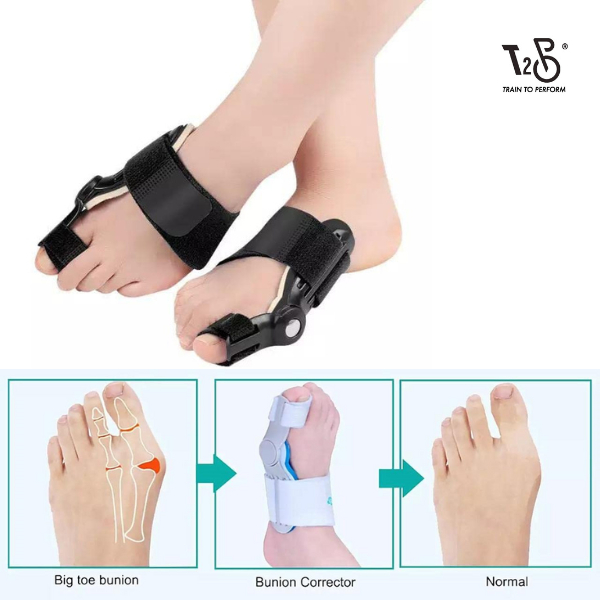 T2P One Pair Big Toe Thumb Valgus Corrector Foot Orthopedic Overlap ...
