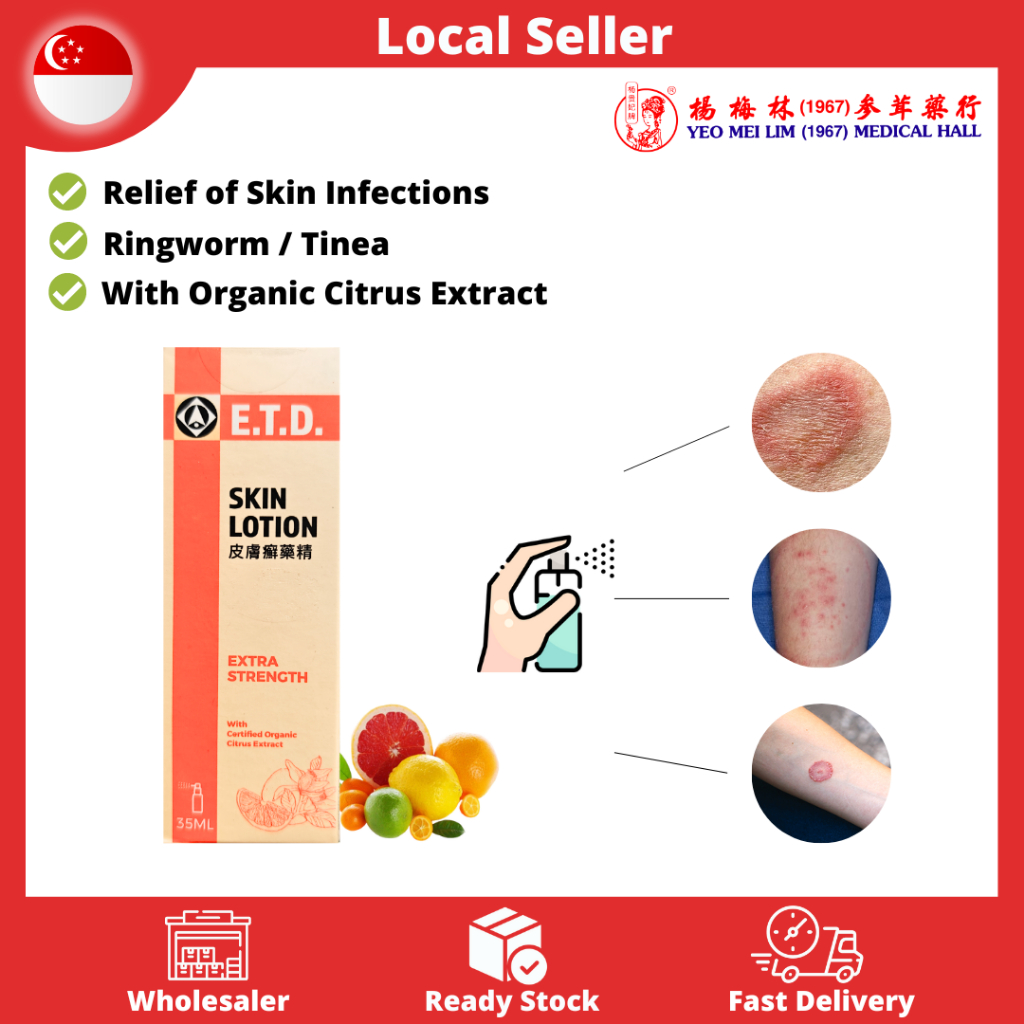 E.T.D. Skin Lotion Spray 35ml for Skin | Ringworm | Tinea | Fungus ...