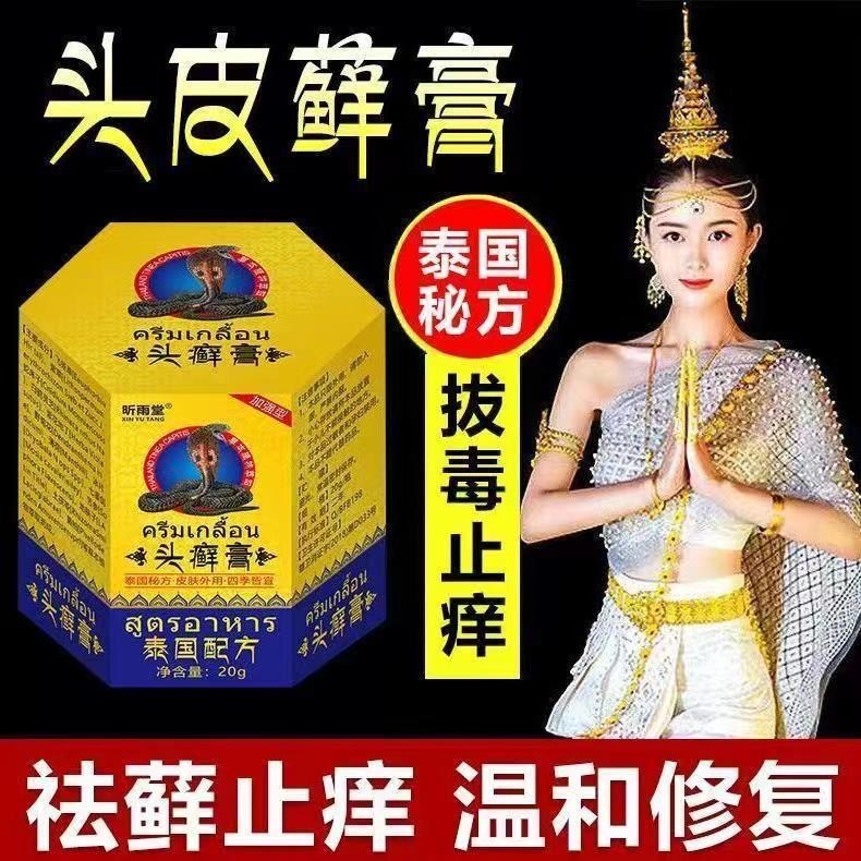 Hot selling 100W tinea capitis cream special for scalp seborrheic ...