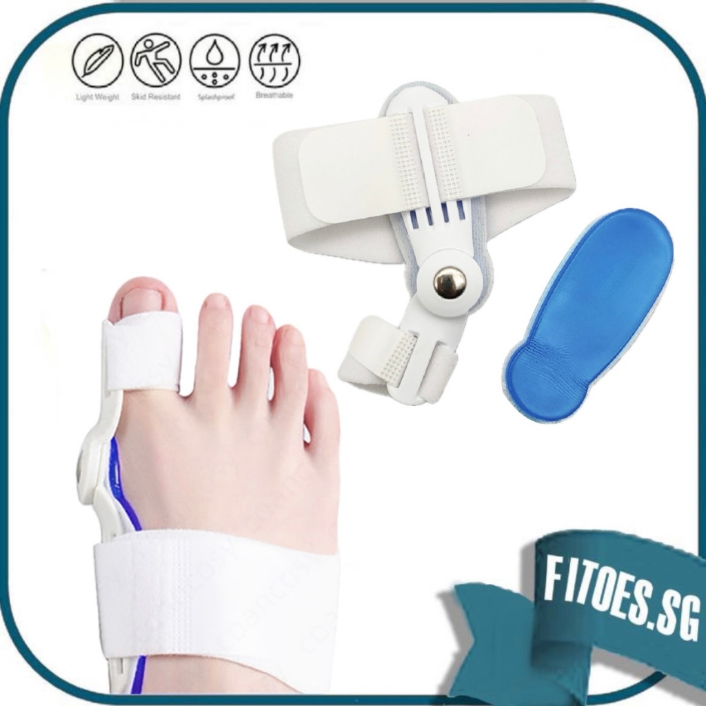 Big Toe Day Night Bunion Splint Big Toe Corrector Hallux Valgus ...