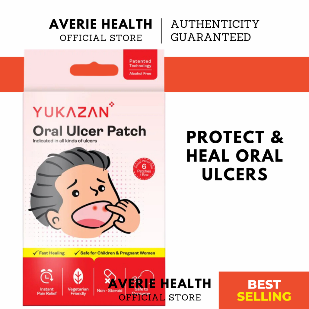Yukazan Oral Ulcer Patch 6s | For All Kinds Of Oral & Canker Ulcers | Shopee Singapore