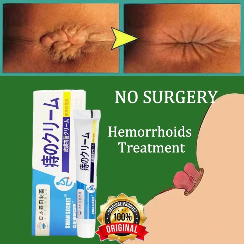 Hemorrhoids cream 痔瘡膏20g Quickly Remove mixed internal and external ... Hemorrhoids cream 痔瘡膏20g Quickly Remove mixed internal and external ...