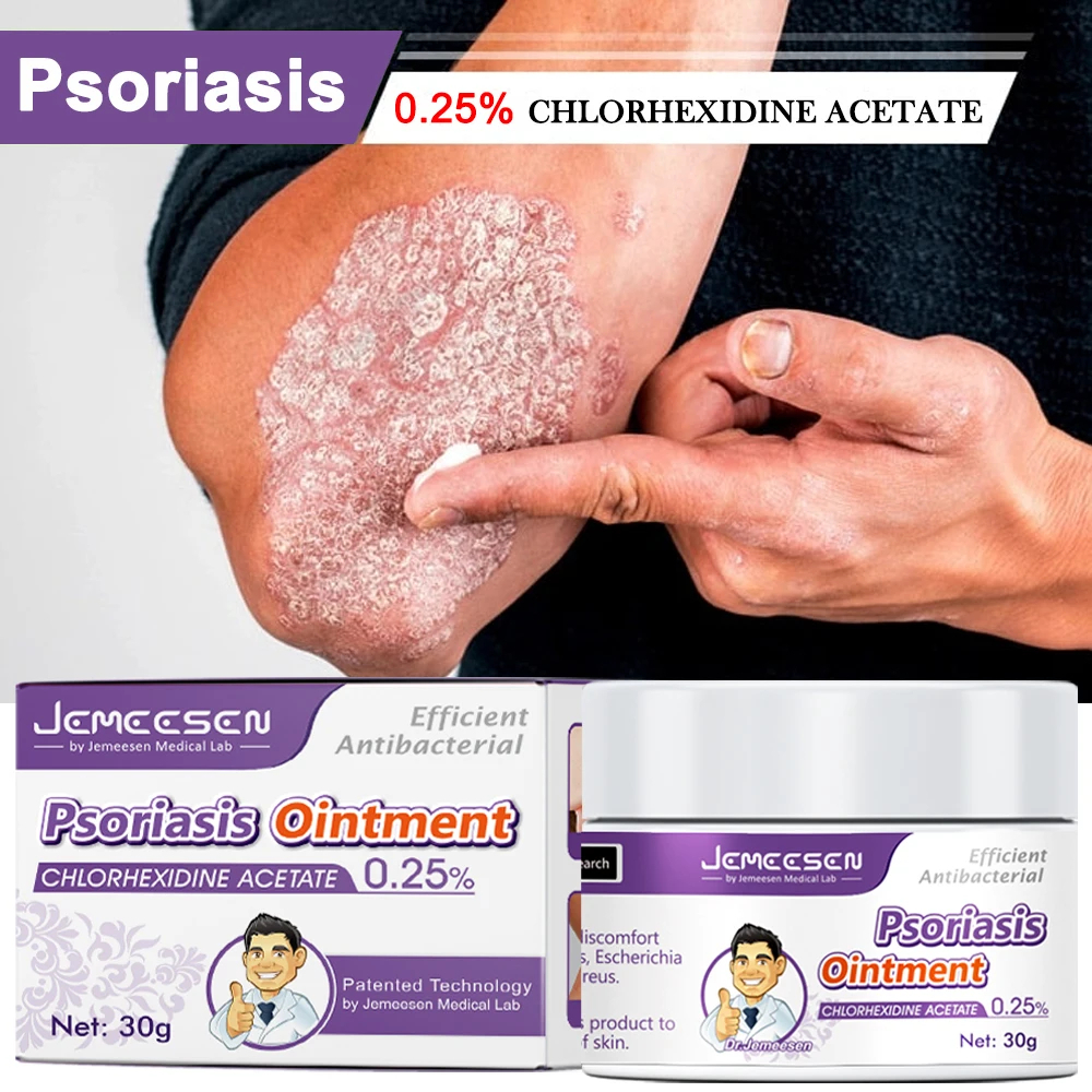 Psoriasis Ointment Antibacterial Eczema Cream Herbal Relief Itchy Skin ...