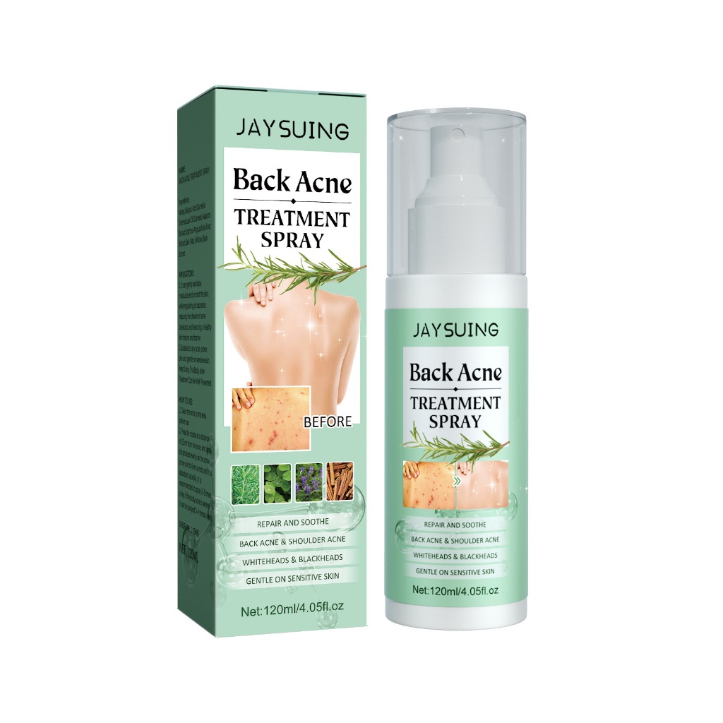SG Stock Back Body Acne Treatment Spray Refining Control Prevent Pimple ...