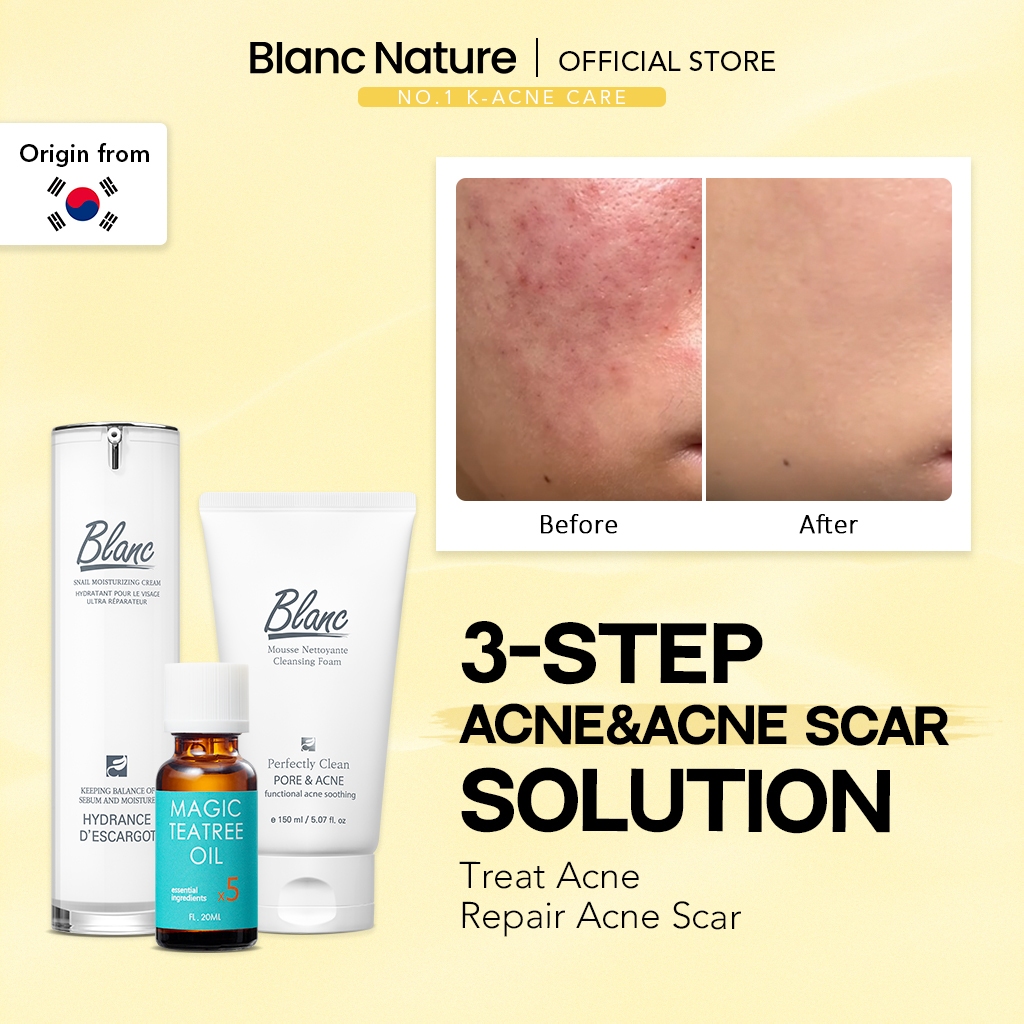 [ Blanc Nature Official ] 3 Step Acne&Acne Scar Solution ( Instant Acne ...
