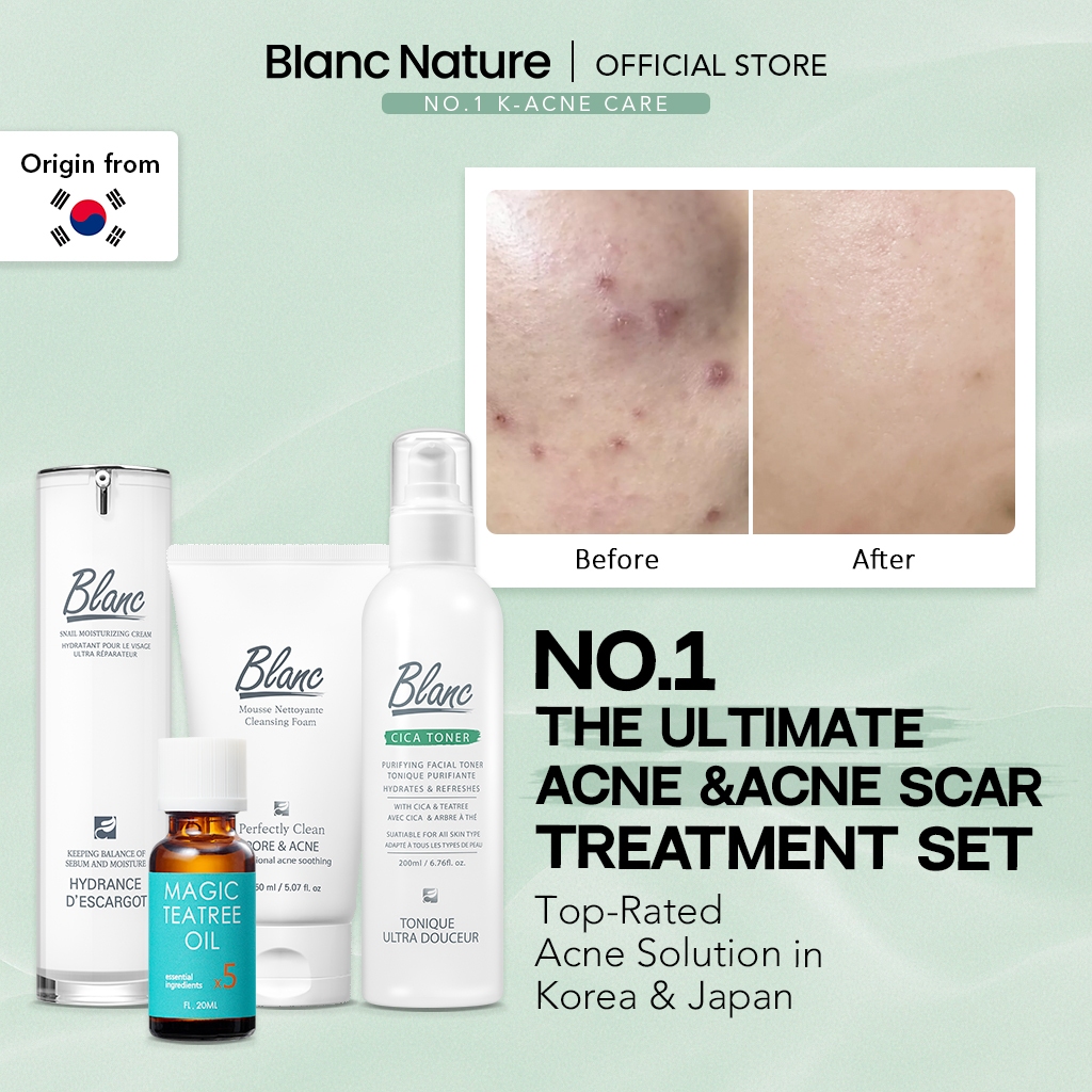 [ Blanc Nature Official ] The Ultimate Acne&Acne Scar Treatment Set ...