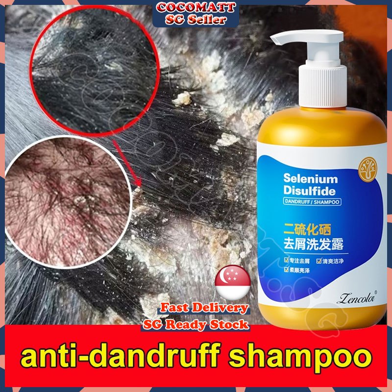 ️𝗦𝗚 𝗦𝗧𝗢𝗖𝗞 ️Selenium sulfide shampoo Anti dandruff shampoo Dandruff ...