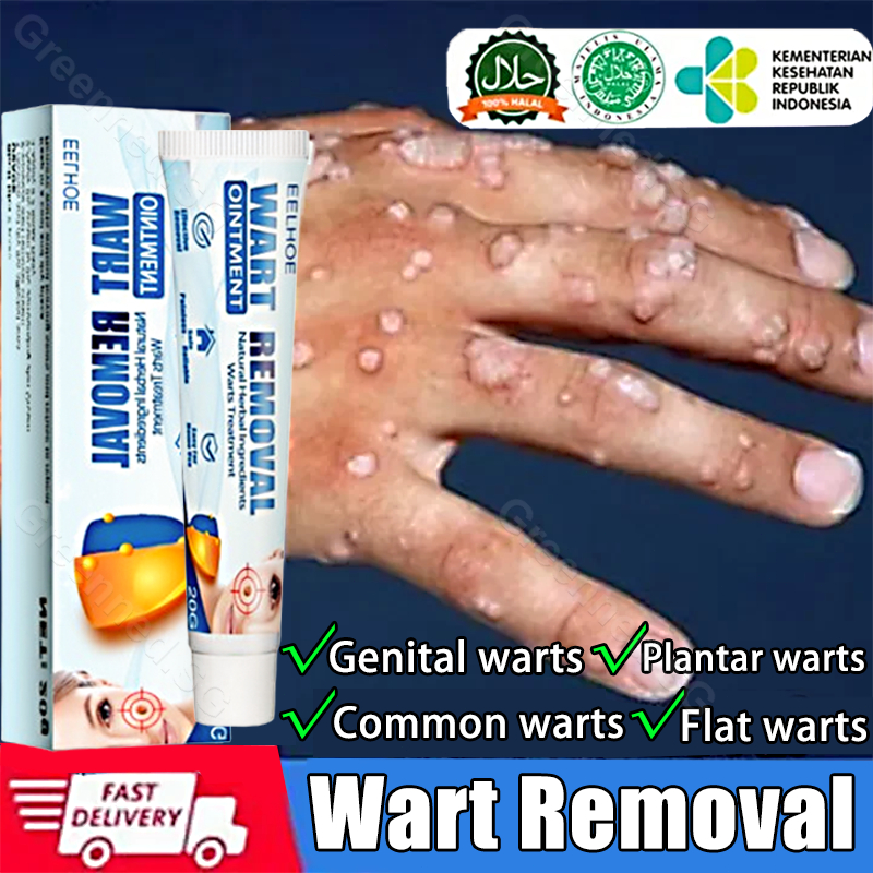 mole removal cream warts removal cream genital warts remover skin tag ...