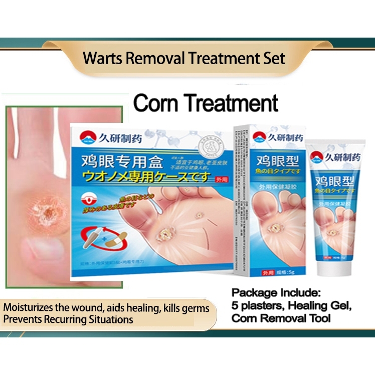 [SG] Foot Corn Warts Callus Removal Treatment Set Cream Plaster Gel ...
