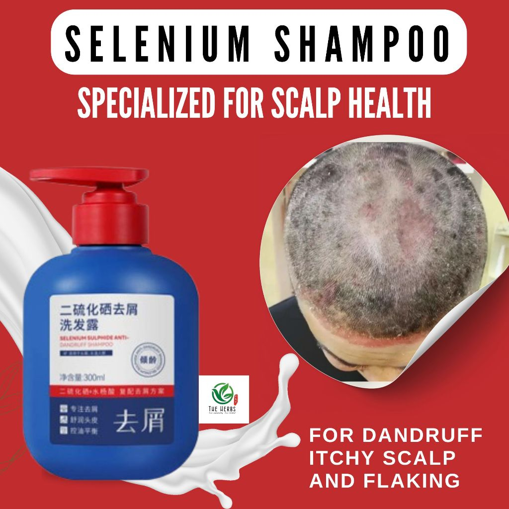 SELENIUM SHAMPOO 二硫化硒洗发水 300ml 头皮问题Anti-dandruff,itching, flaking ...