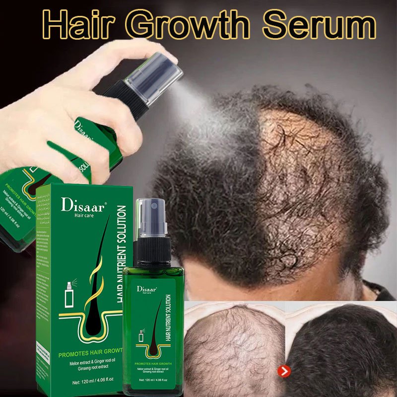 Anti Hair Loss Serum 120ml Hair Growth Serum Promotes Hair Growth ...
