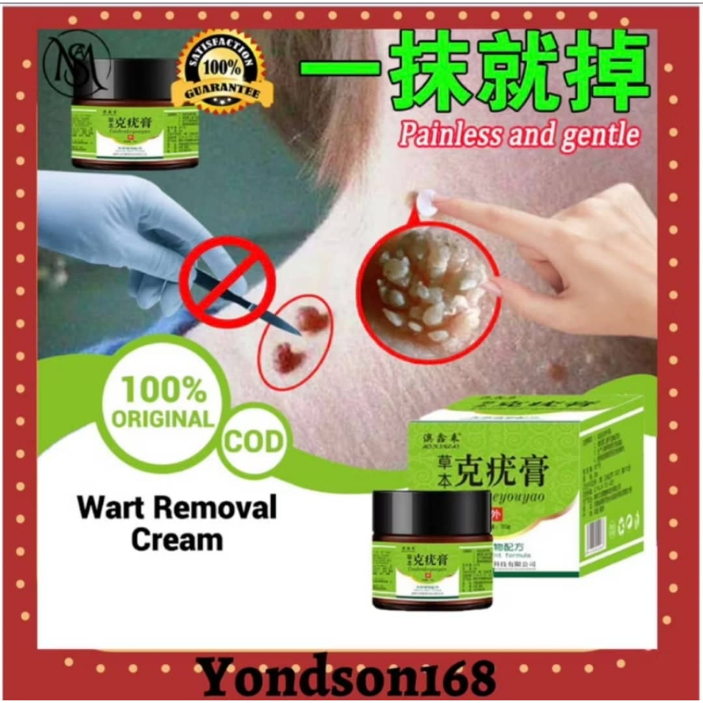wart remover warts removal cream ubat buang tahi lalat buang kutil Neck ...
