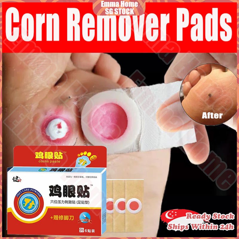 🚀SG stock🚀 Corn removal plaster / Painless removal chicken eye Corn ...