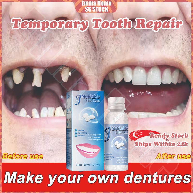 🚀𝒔𝒈 𝒔𝒕𝒐𝒄𝒌🚀 Temporary tooth repair / Fake teeth Filling moldable false ...