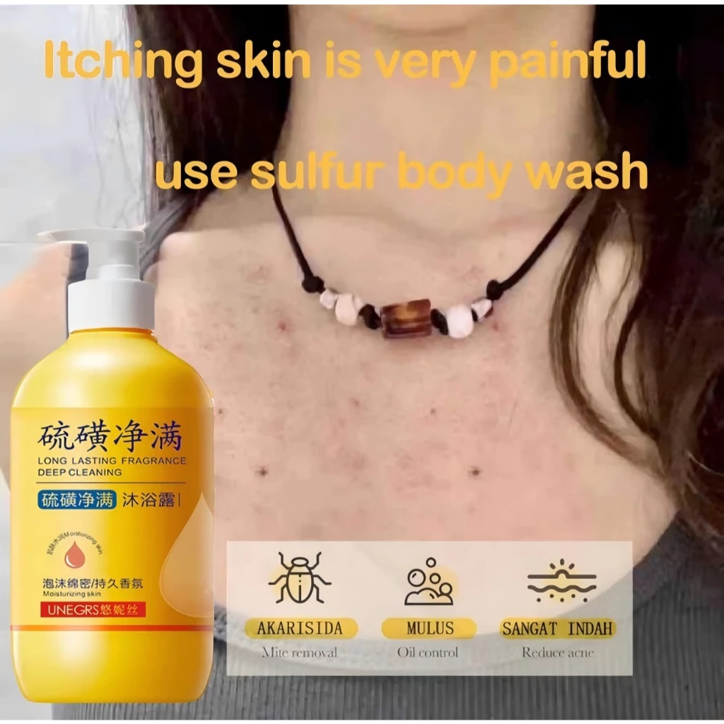 ⭐COD⭐Sulphur Soap Mite Removal Stops itching Inhibits bacteria Deep ...