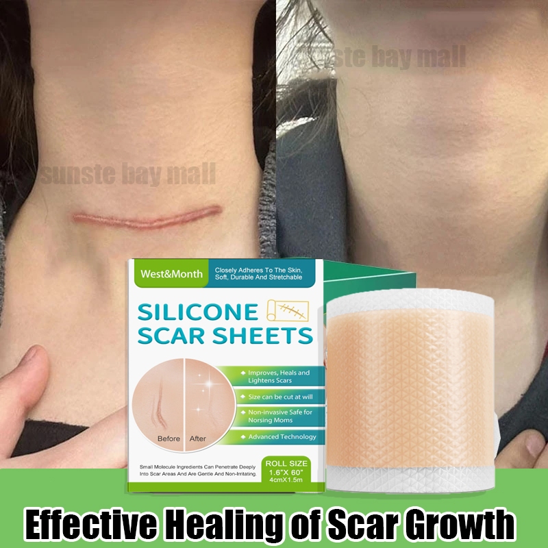 silicone scar sheet scar removal patch acne scar stretch mark keloid scar patch silicon scar ...
