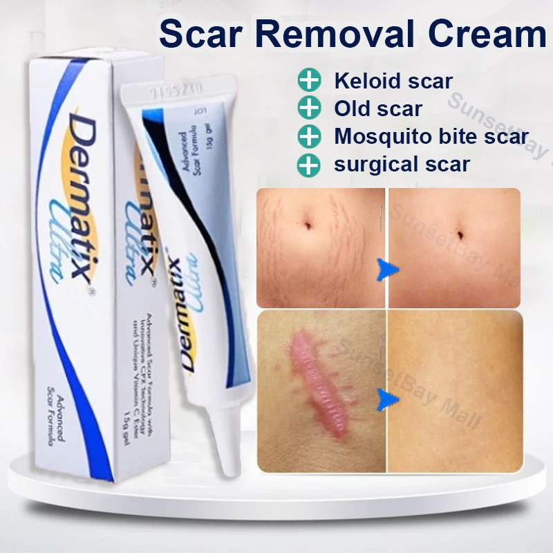 dermatix ultra scar gel scar removal cream stretch mark keloid scar ...
