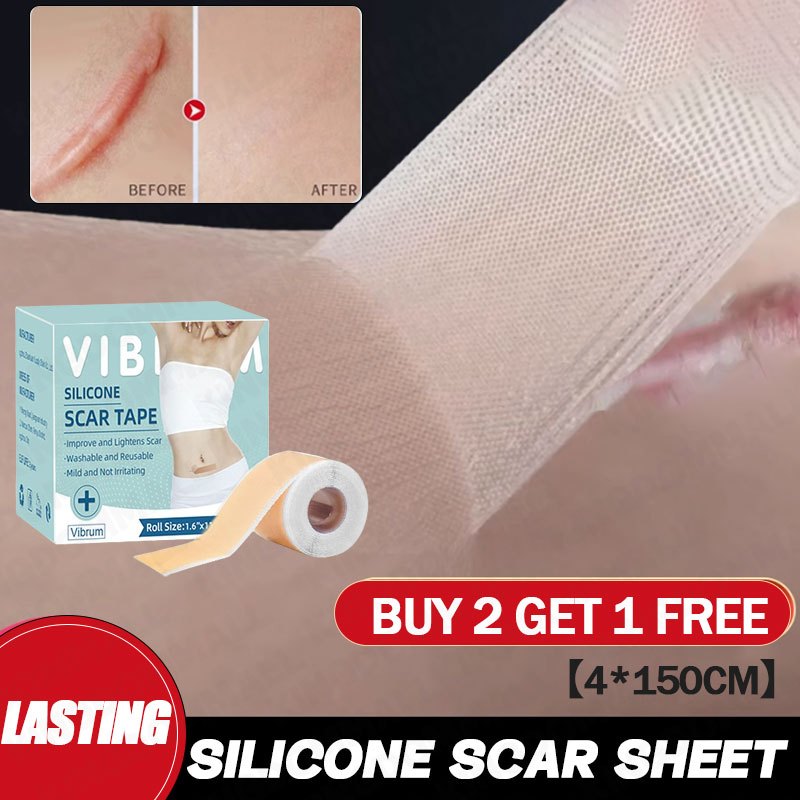 Silicone Scar Sheet Scar Removal Patch Scar Tape C Section Scar Tattoo ...