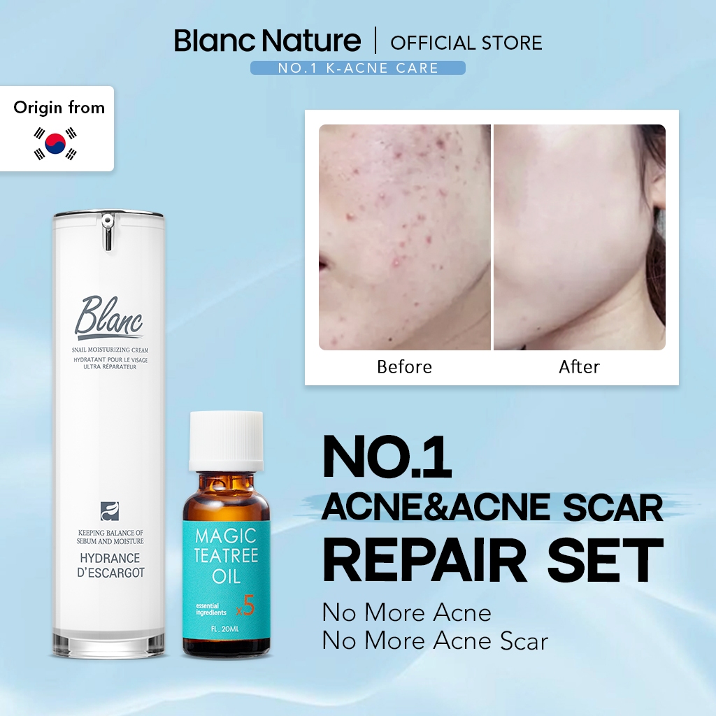 [ Blanc Nature Official ] Acne&Acne Scar Repair Set ( Instant Acne Spot ...