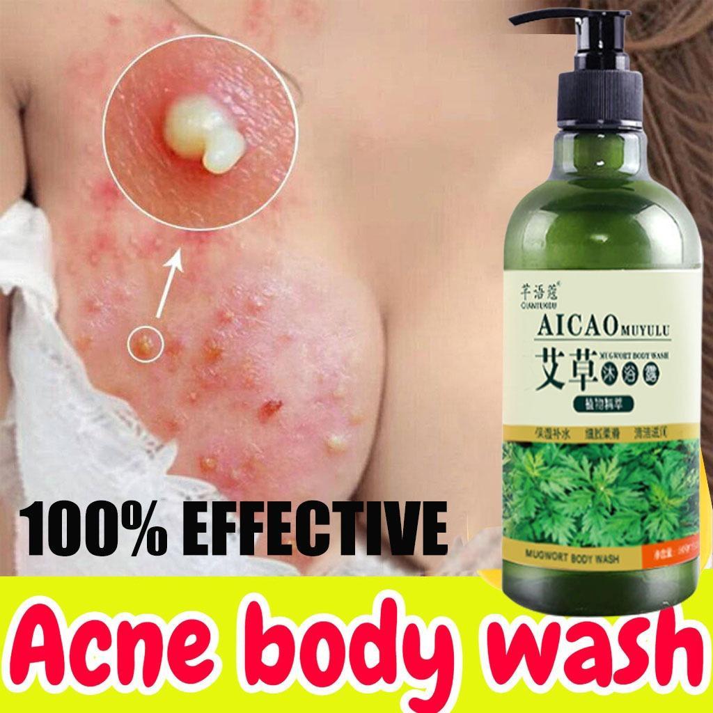 Mugwort Body Wash Antibacterial and Anti-mite Back Acne Body Wash 500ML Eczema Anti-fungal Acne ...