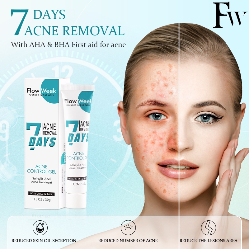 FlowWeek Salicylic Acid Acne Remover Cream Anti Acne Treatment Pimple ...