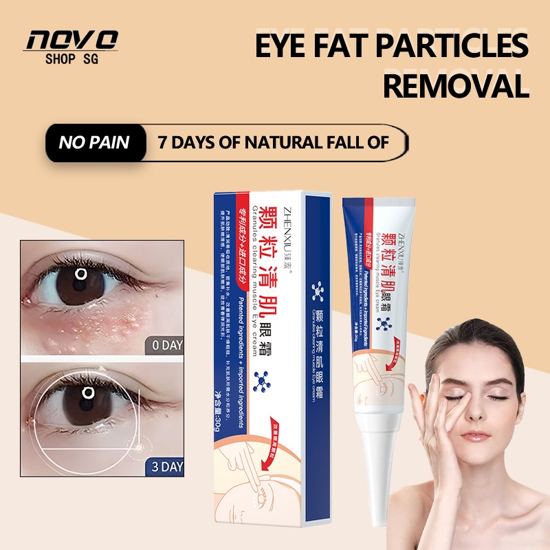 Eye Cream Milia Seed Removal 20g Efficient Remove Fat Particle Eye Bag ...