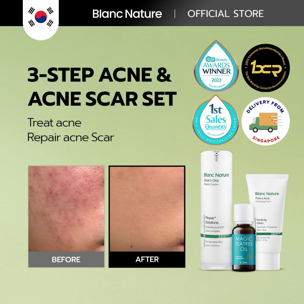 3 Step Acne & Acne Scar Solution (Acne Spot Remover+Pimple Face ...