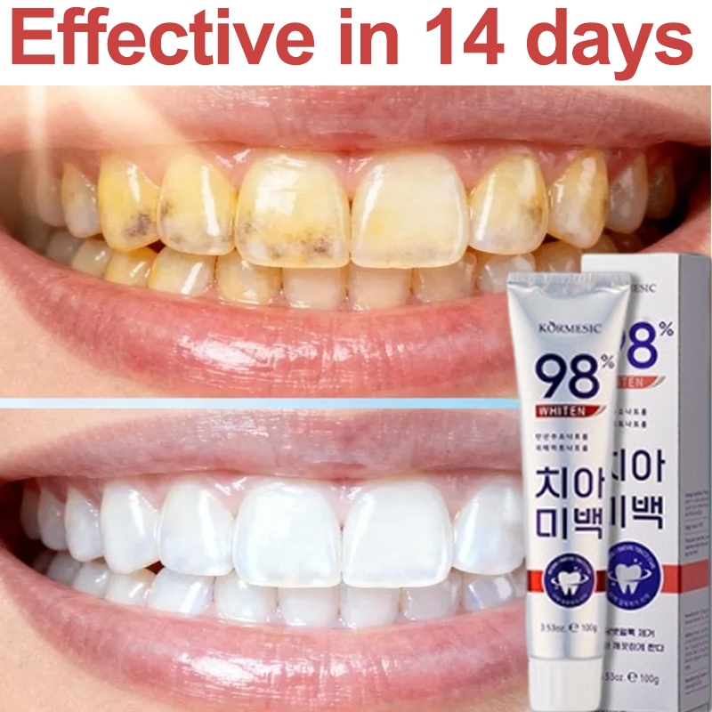 Korean whitening toothpaste 100g Teeth Whitening Removal Yellow Stains ...