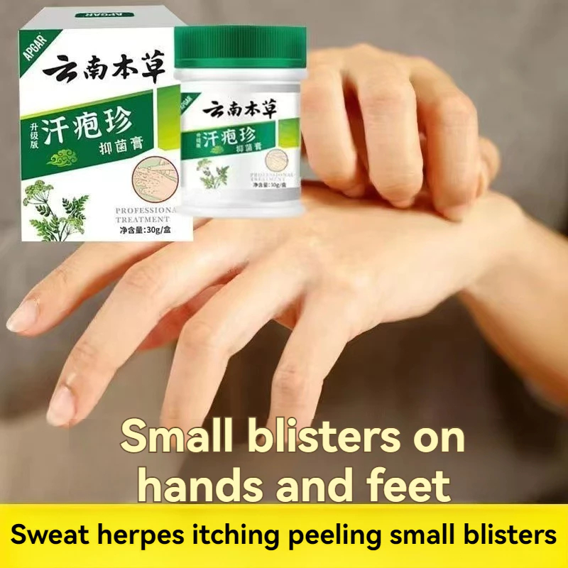 Yunnan Herbal Antipruritic Cream Itch Relief Hand And Foot Skin Itching ...