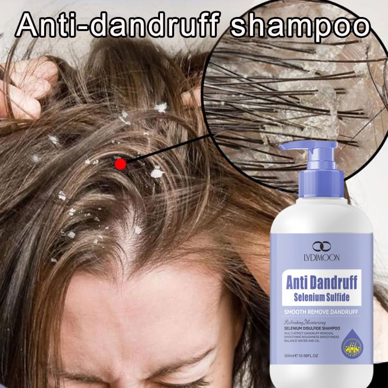 Selenium Disulfide Anti Dandruff Shampoo 300ml Remove Dandruff Oil ...