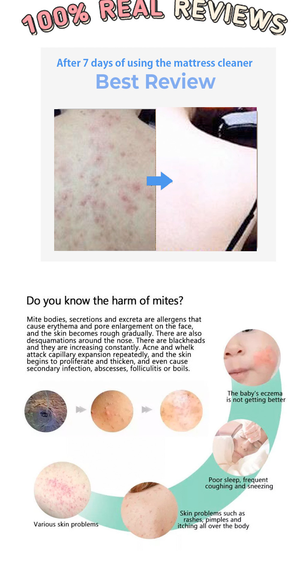 😍【SG INSTOCK】Mattress Cleaner Spray -Anti Fungal Lice Mould Dust Mites ...