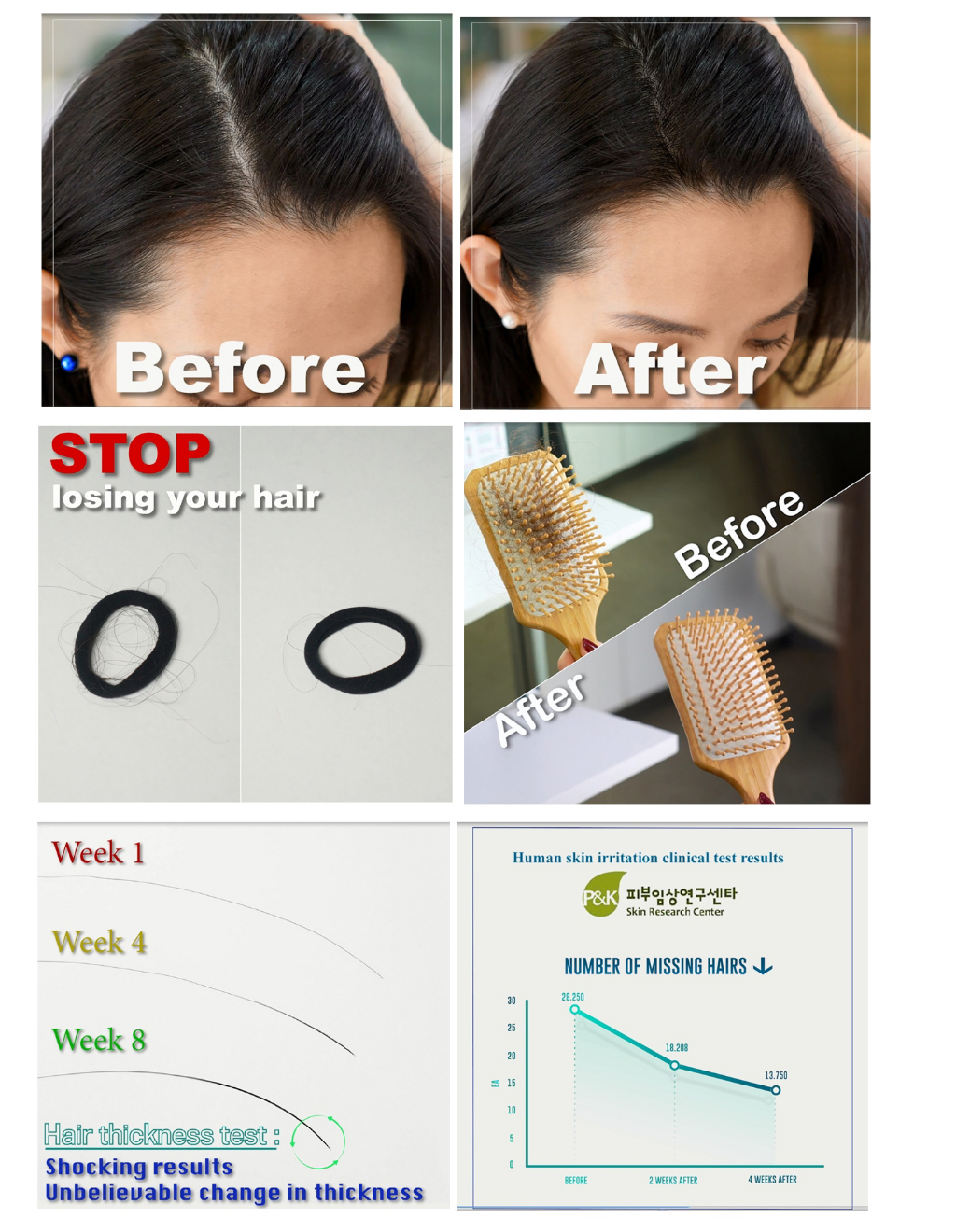 [SMIB] Xmas Gift box Set Edition - Anti Hair Loss Shampoo + Treatment ...