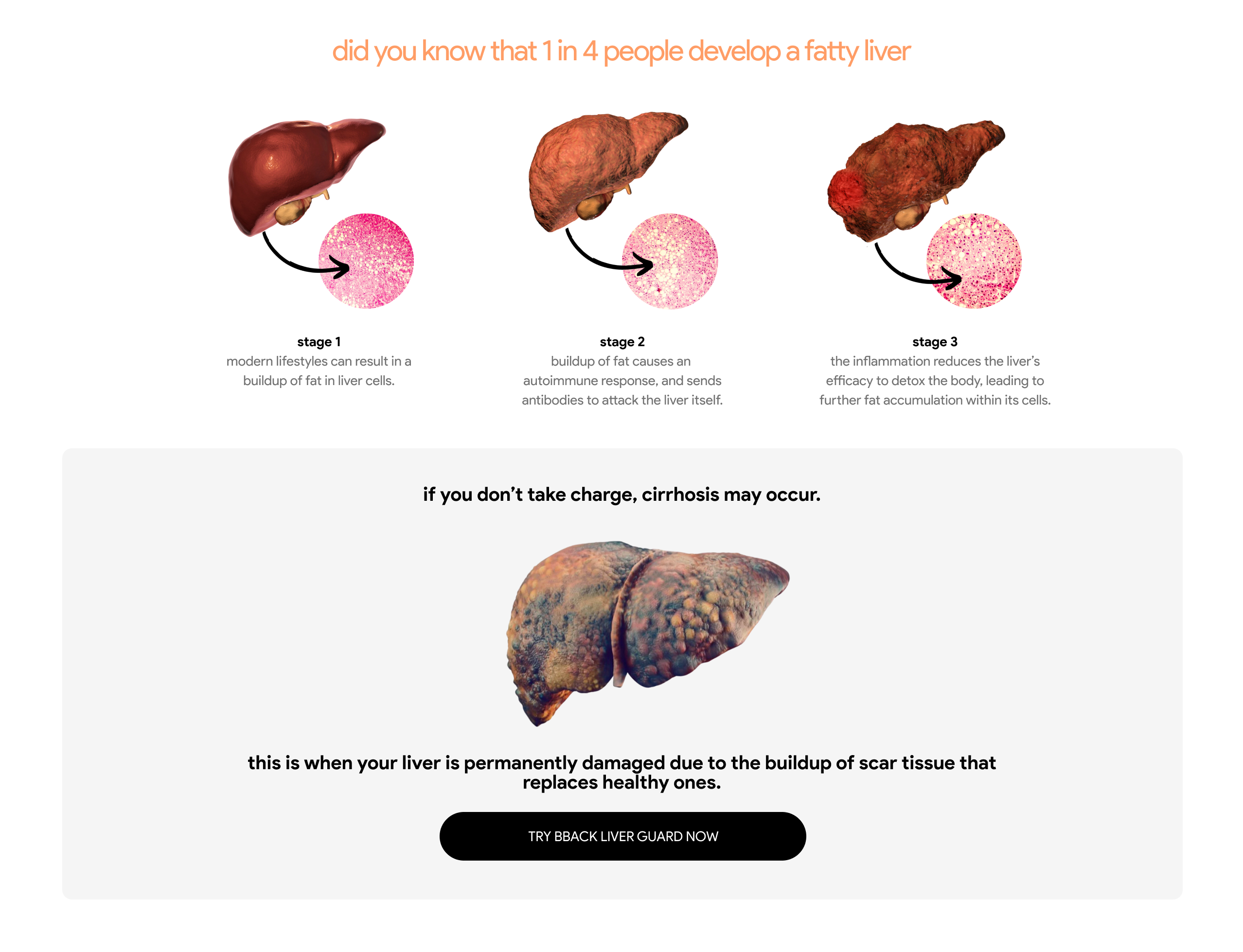 bback / Bounceback Liver Guard Daily Supplement | Shopee Singapore