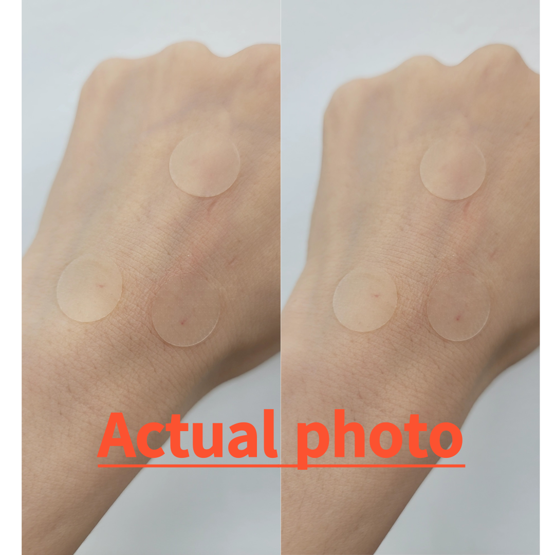 [KOREA] 🇰🇷 Authentic⭐Dimple band 80 70 patchaes 15mm, 12mm Hydrocolloid ...