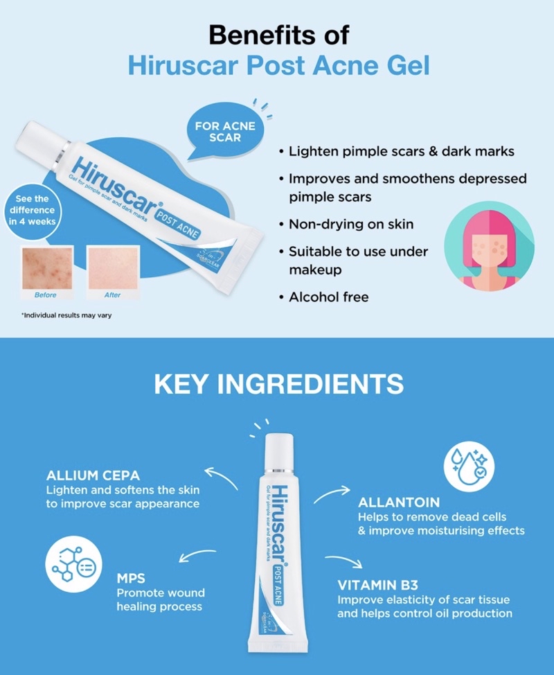 [EXP 05/27] [Free Shipping] Hiruscar Post-Acne Spot Gel 10g | Reduce ...