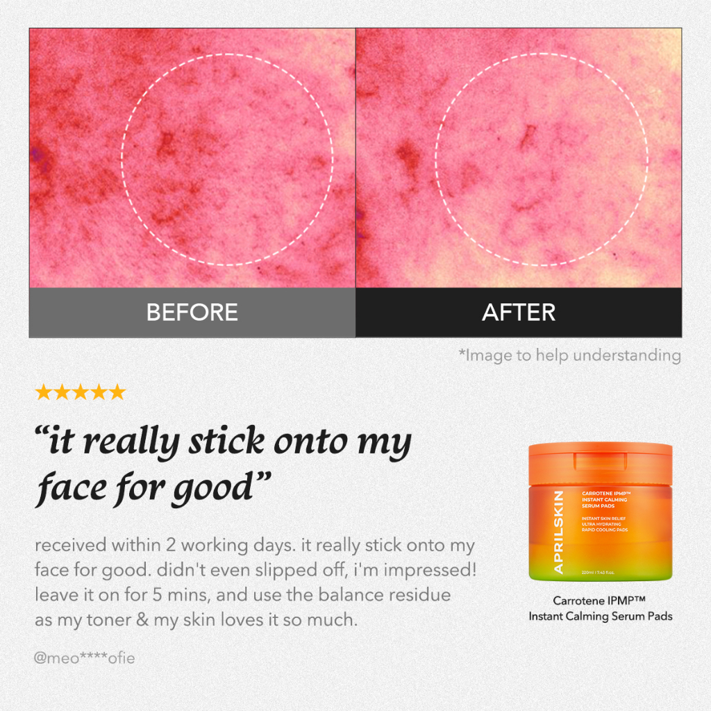 [APRILSKIN official] Carrotene IPMP™ Instant Calming Serum Pads | 5 ...
