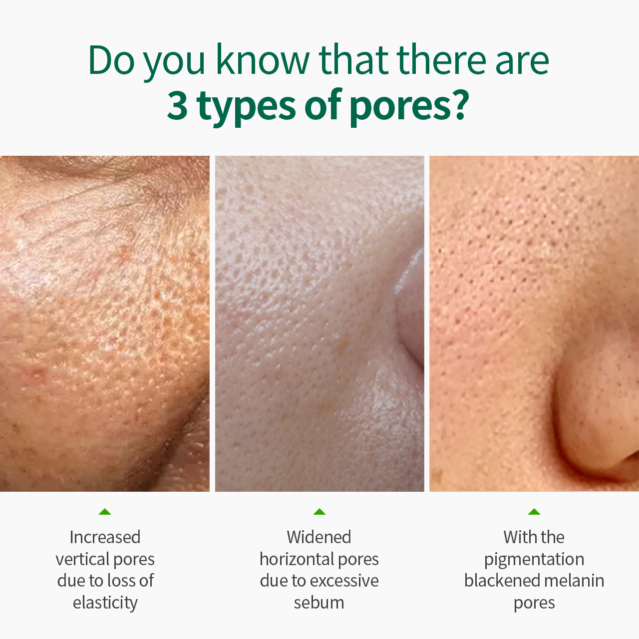 [SUNGBOON EDITOR] BIG SIZE Green Tomato Pore Lifting Ampoule+ 75ml ...