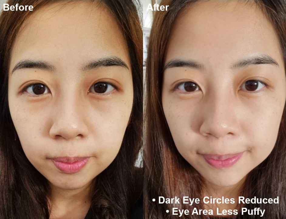 AUOLIVE EYES LIFTER Eye Serum - Reduces Dark Eye Circles, Puffiness ...