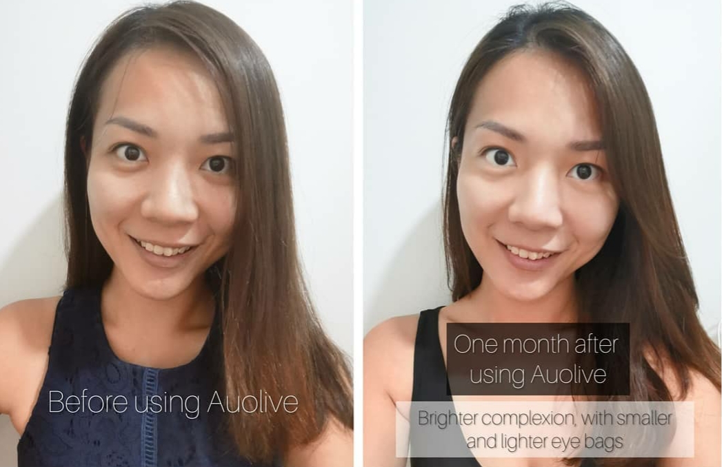 AUOLIVE EYES LIFTER Eye Serum - Reduces Dark Eye Circles, Puffiness ...