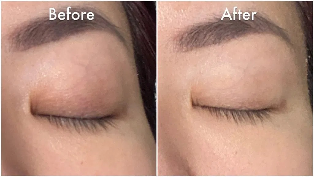 AUOLIVE EYES LIFTER Eye Serum - Reduces Dark Eye Circles, Puffiness ...
