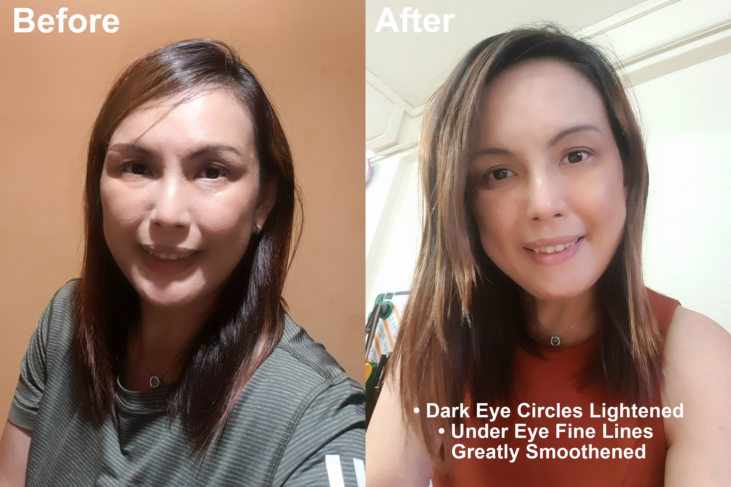 AUOLIVE EYES LIFTER Eye Serum - Reduces Dark Eye Circles, Puffiness ...