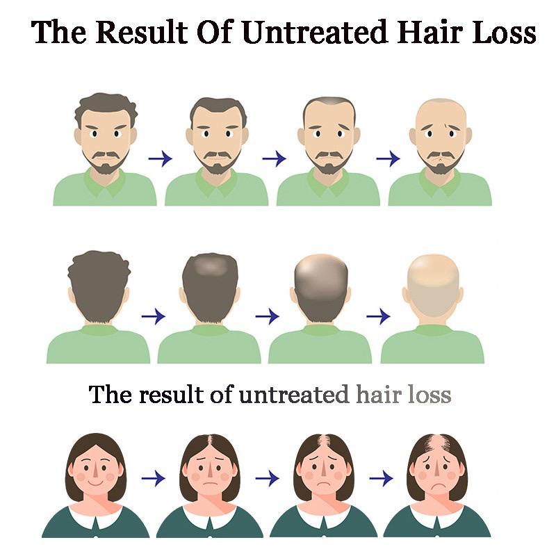 Hair Tonic Spray Hair Growth Serum Anti Hair Loss Serum Hair Loss Solution Promote Hair Growth