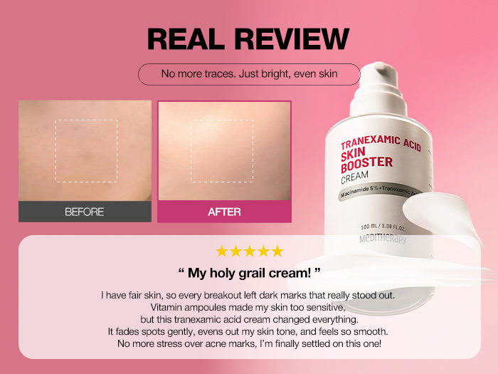 [MEDITHERAPY Official] Tranexamic Acid Skin Booster Cream 100ml ...