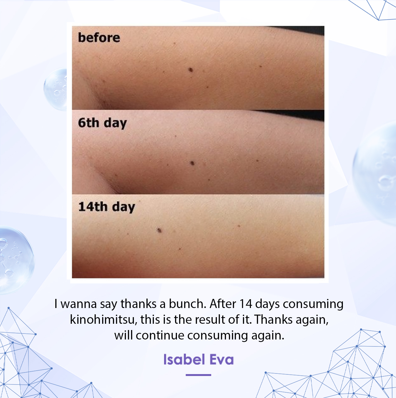 Kinohimitsu ProWhite Glutathione Inner Beauty Supplement Sachet 8g ...