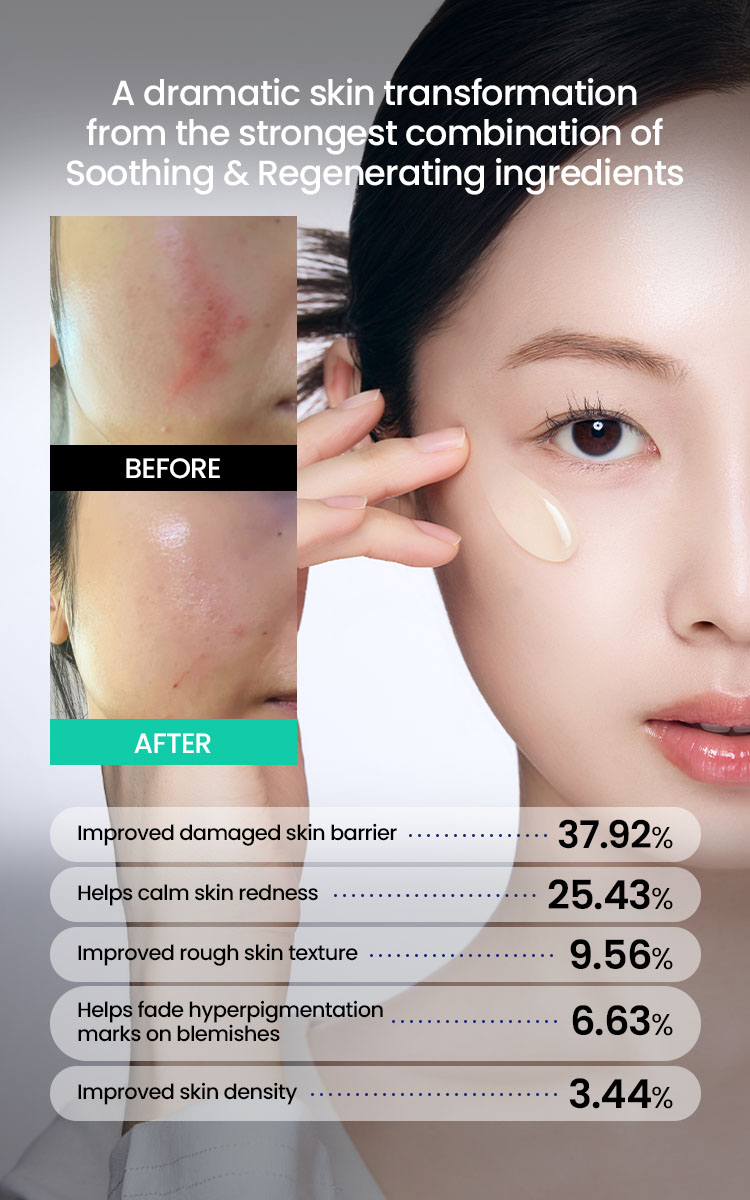 BEPLAIN OFFICIAL CICA PDRN SKIN BOOSTER SERUM 30ml | Boosts skin ...