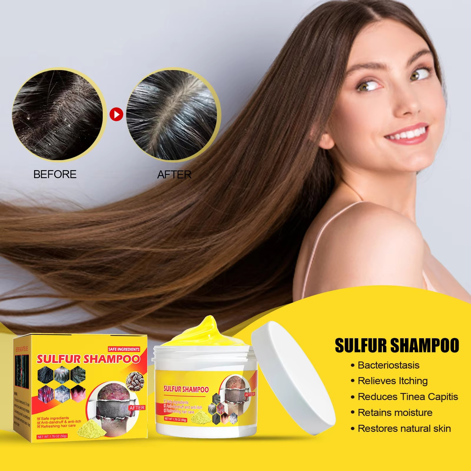 Hair Lice and Demodex Mites Removal - Sulfur Hair Treatment Mask 50ml ...