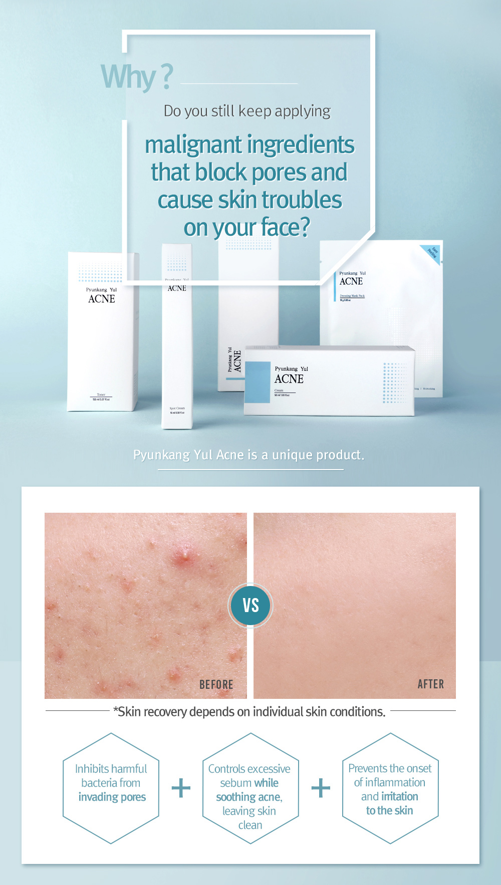 [Pyunkang Yul] ACNE Cream 50ml | Shopee Singapore