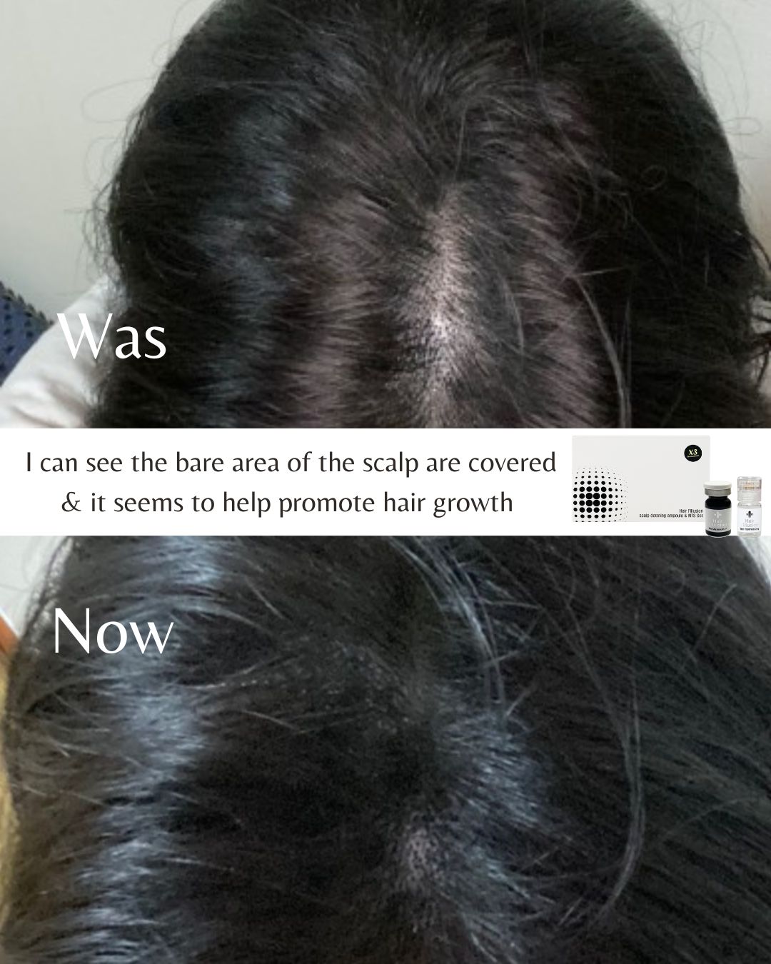 (SUPER SHINY SKIN OFFICIAL STORE) Hair Fillusion The Maximum - COCOMO ...