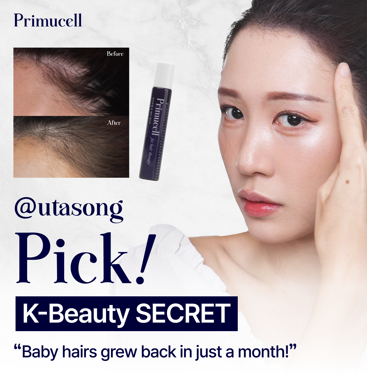 PRIMUCELL for Hair Therapy, Anti-Hair Loss Ampoule (32weeks care ...
