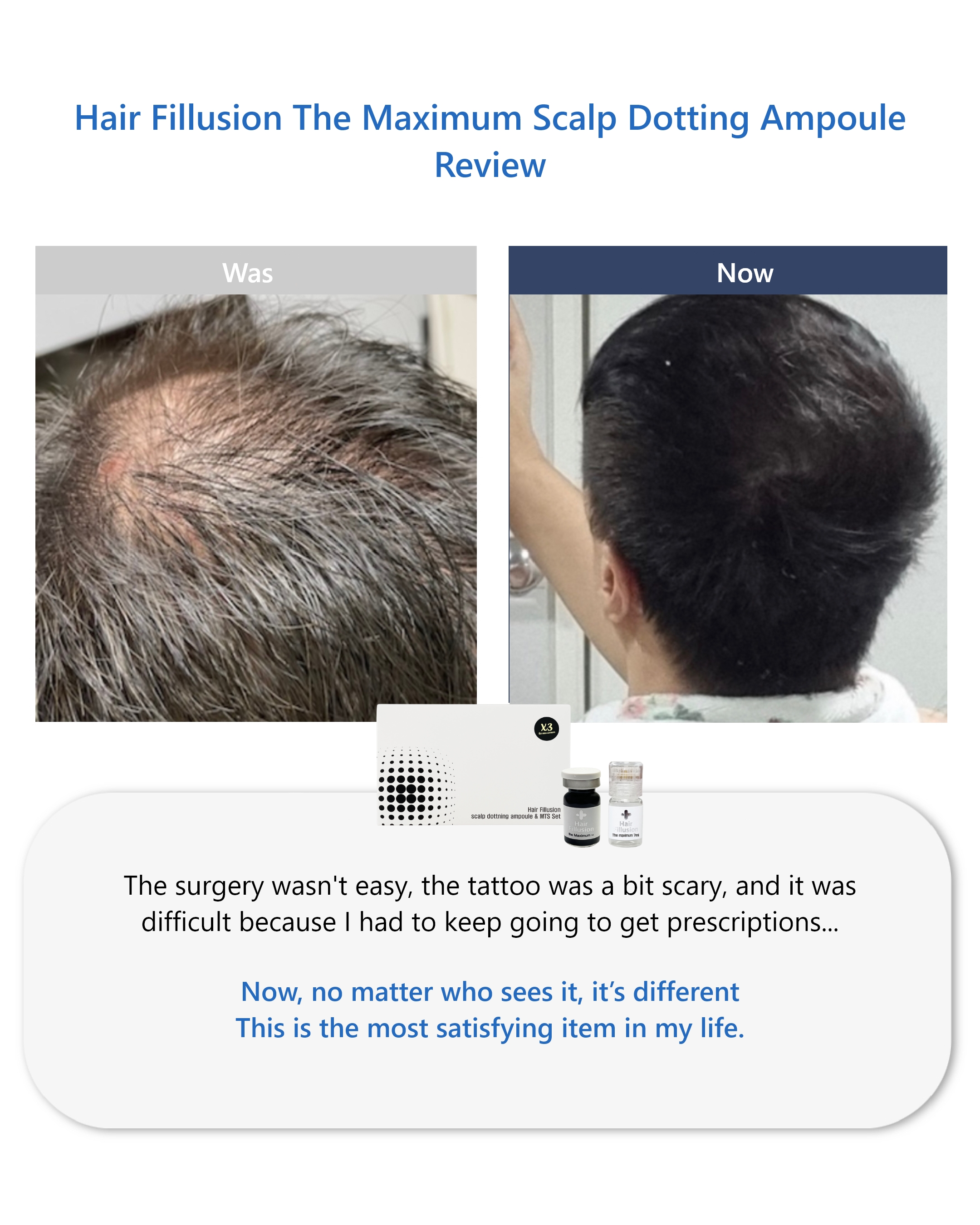 (SUPER SHINY SKIN OFFICIAL STORE) Hair Fillusion The Maximum - COCOMO ...